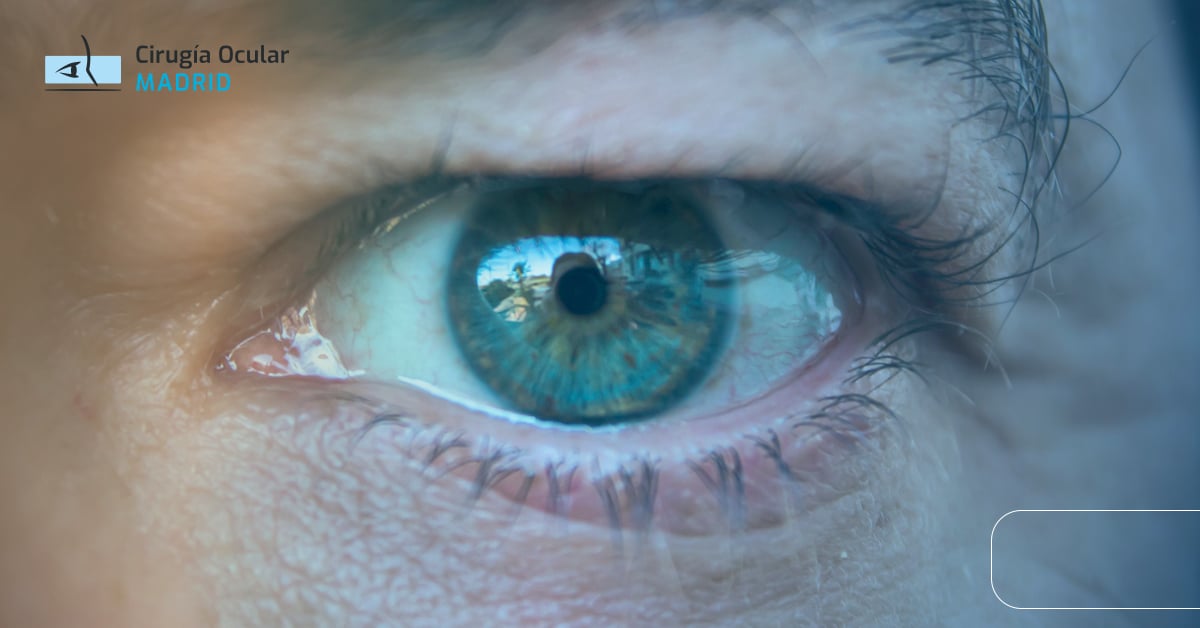 Cuerpo Ciliar: Anatomía, Funciones y Patologías