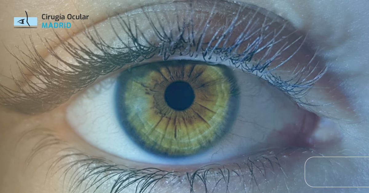 Degeneración macular seca: síntomas y tratamientos