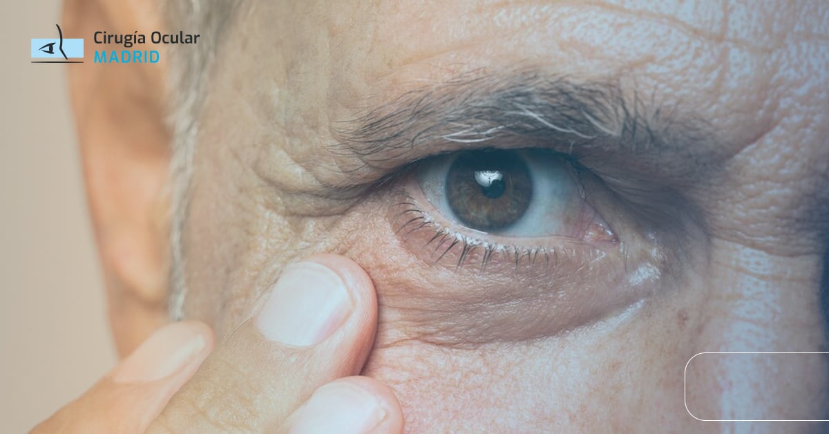 Visión borrosa: causas, tratamiento y cuándo acudir al médico