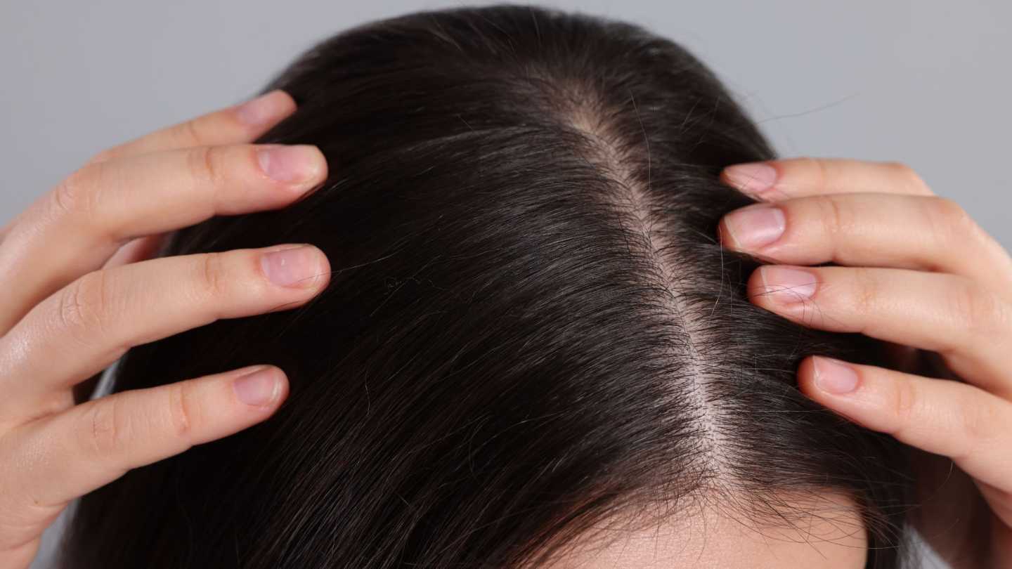 Peroxide in Hair Colour: 5 Facts You Should Know - AIC