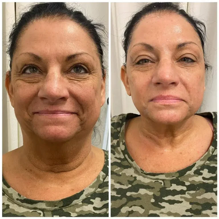 Home - Ageless Med Spa