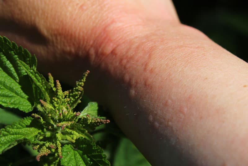 Les vertus et les bienfaits de l'ortie piquante - Nutri Green Planet