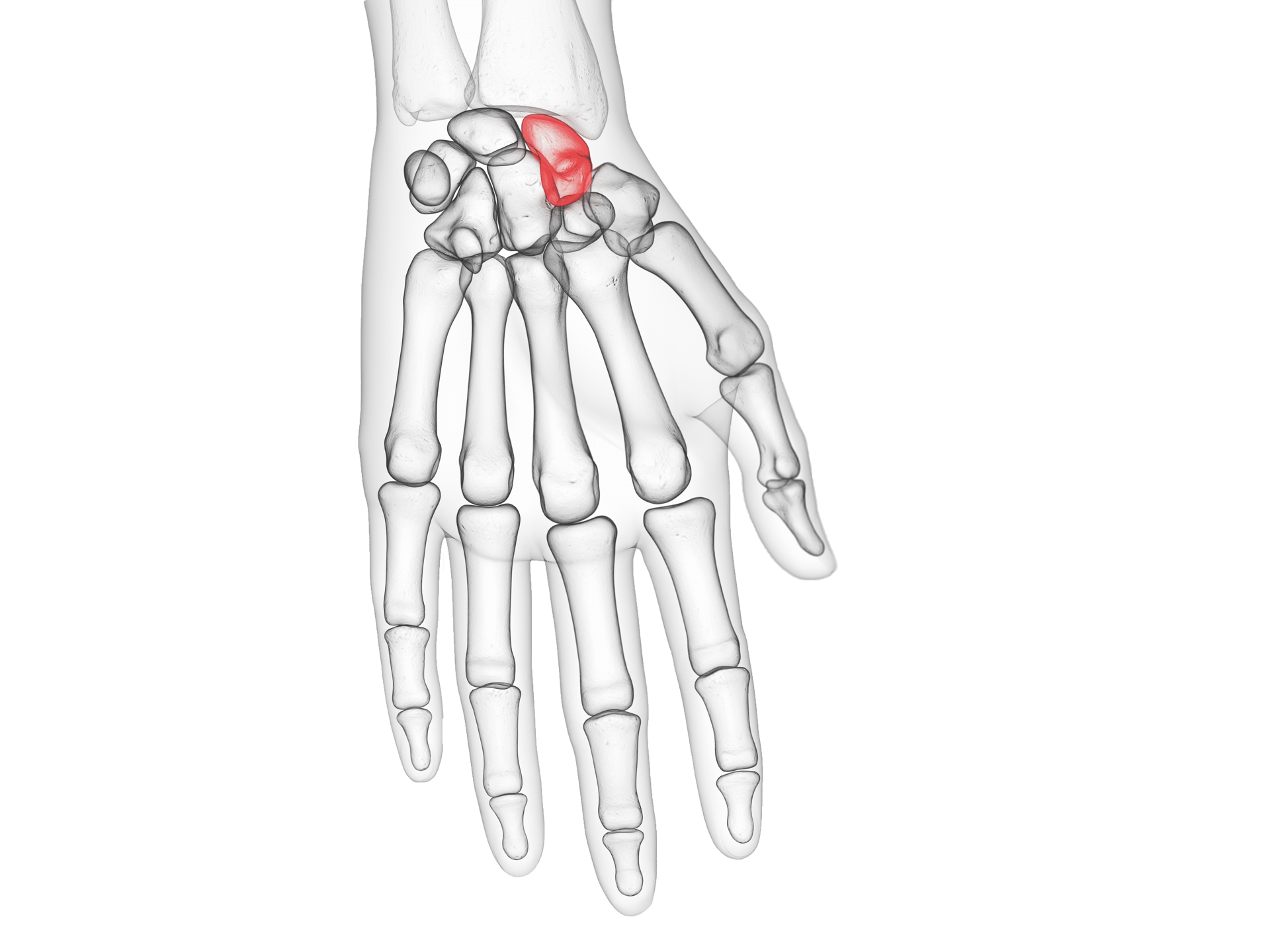 Kahnbeinfraktur & Pseudarthrose: 10 Fakten | Heilung & Therapie